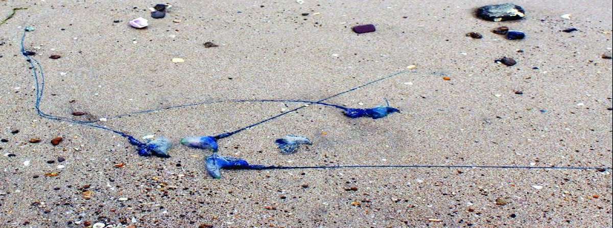 The Blue Bottle Jellyfish Bites Three Tourist